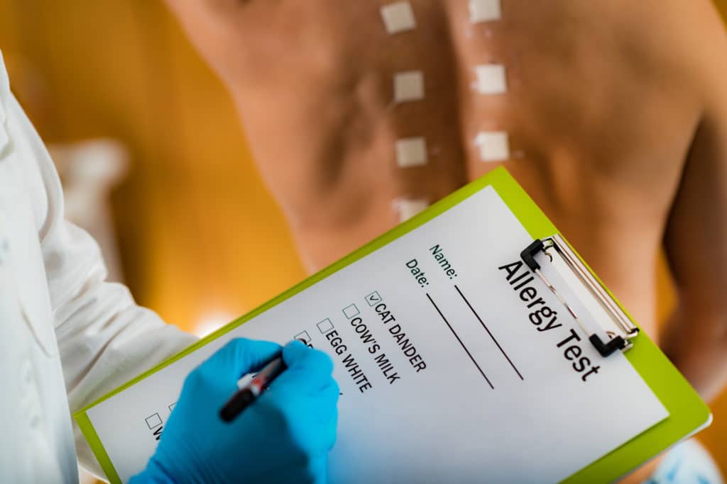 Allergy Patch Testing Los Angeles - Allergic Contact Dermatitis Test
