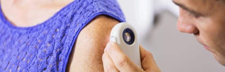 Electrodesiccation and Curettage Treatment Los Angeles CA